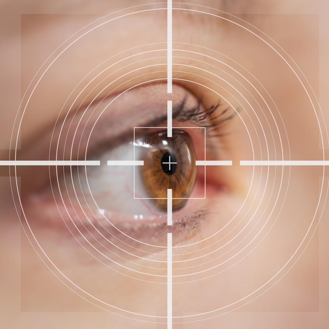 Cataract and Lasik Surgery at Same Time? Shekar Eye Hospital